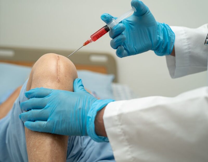 PRP Therapy in Largo - OrthoLiving